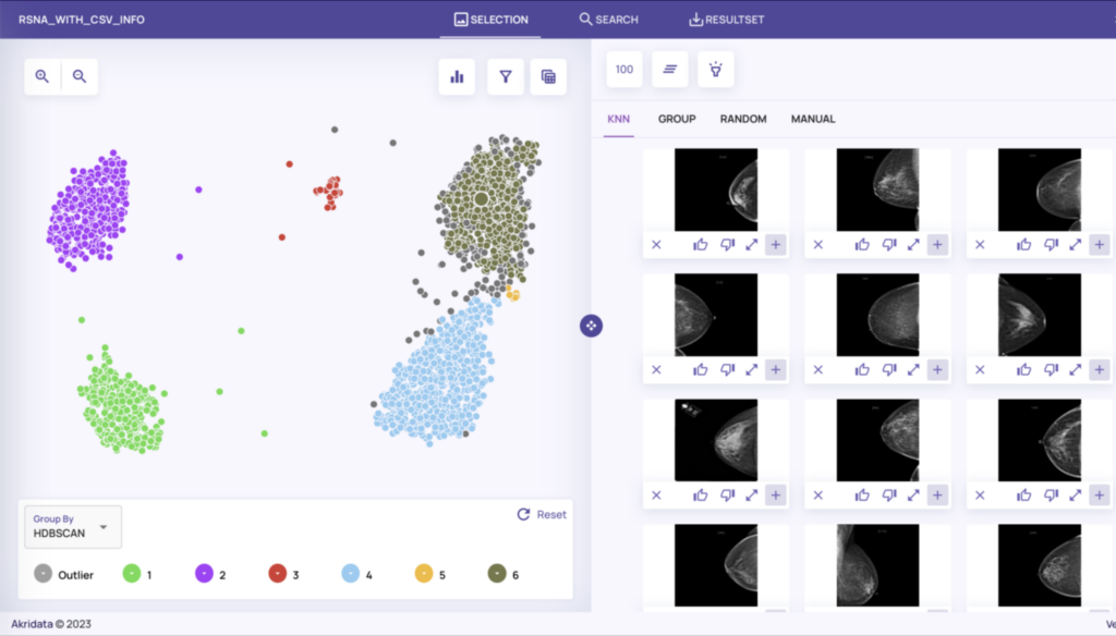 Data Explorer for Kaggle